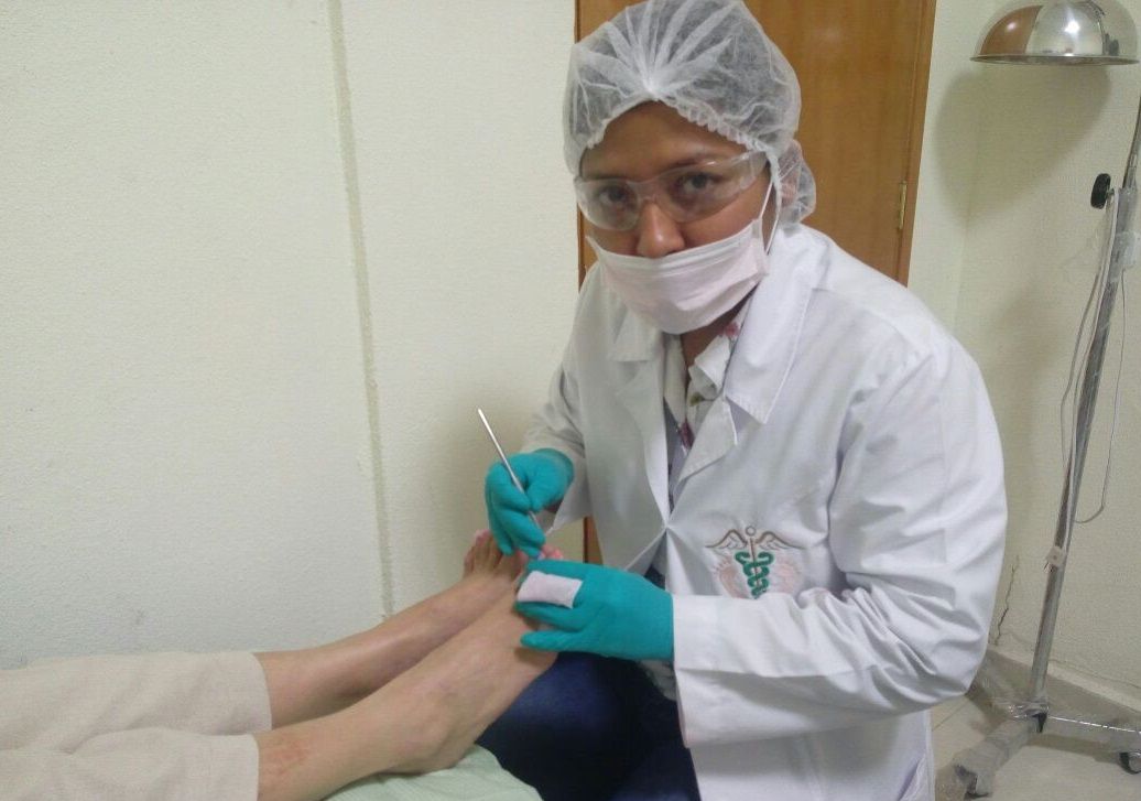 ¿QUE SON LOS HELOMAS Y POR QUE SALEN ? | http://www ...